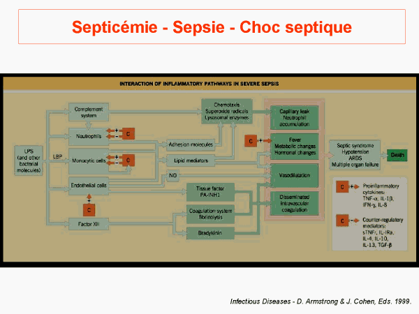 Septicémie - Sepsie - Choc septique